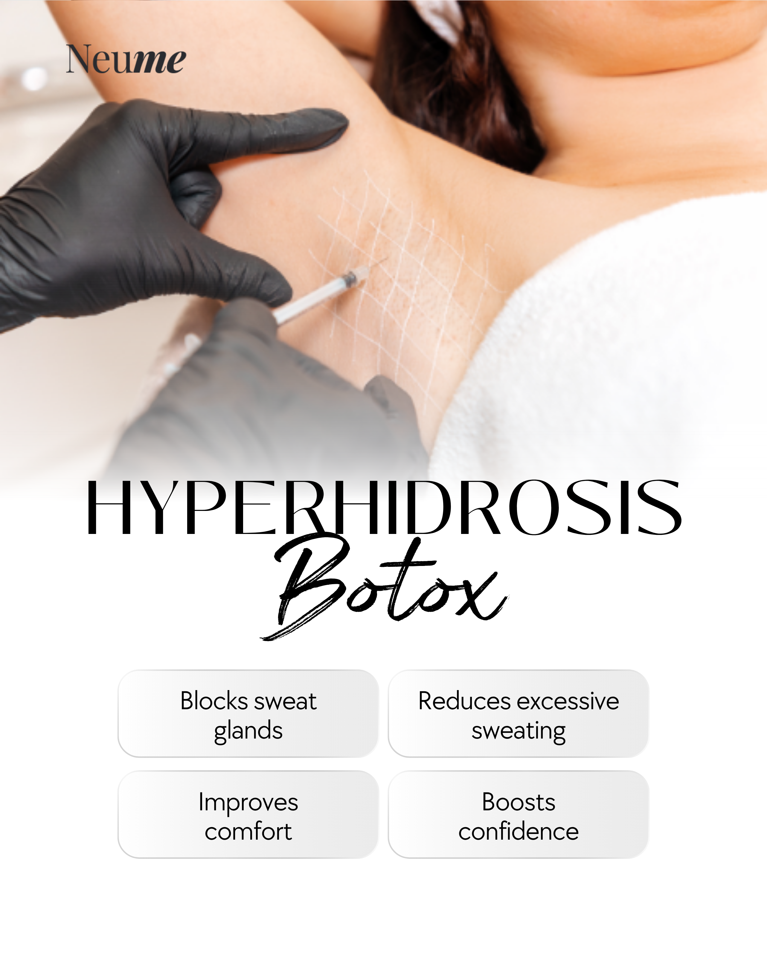 Hyperhidrosis Botox — Neume Services