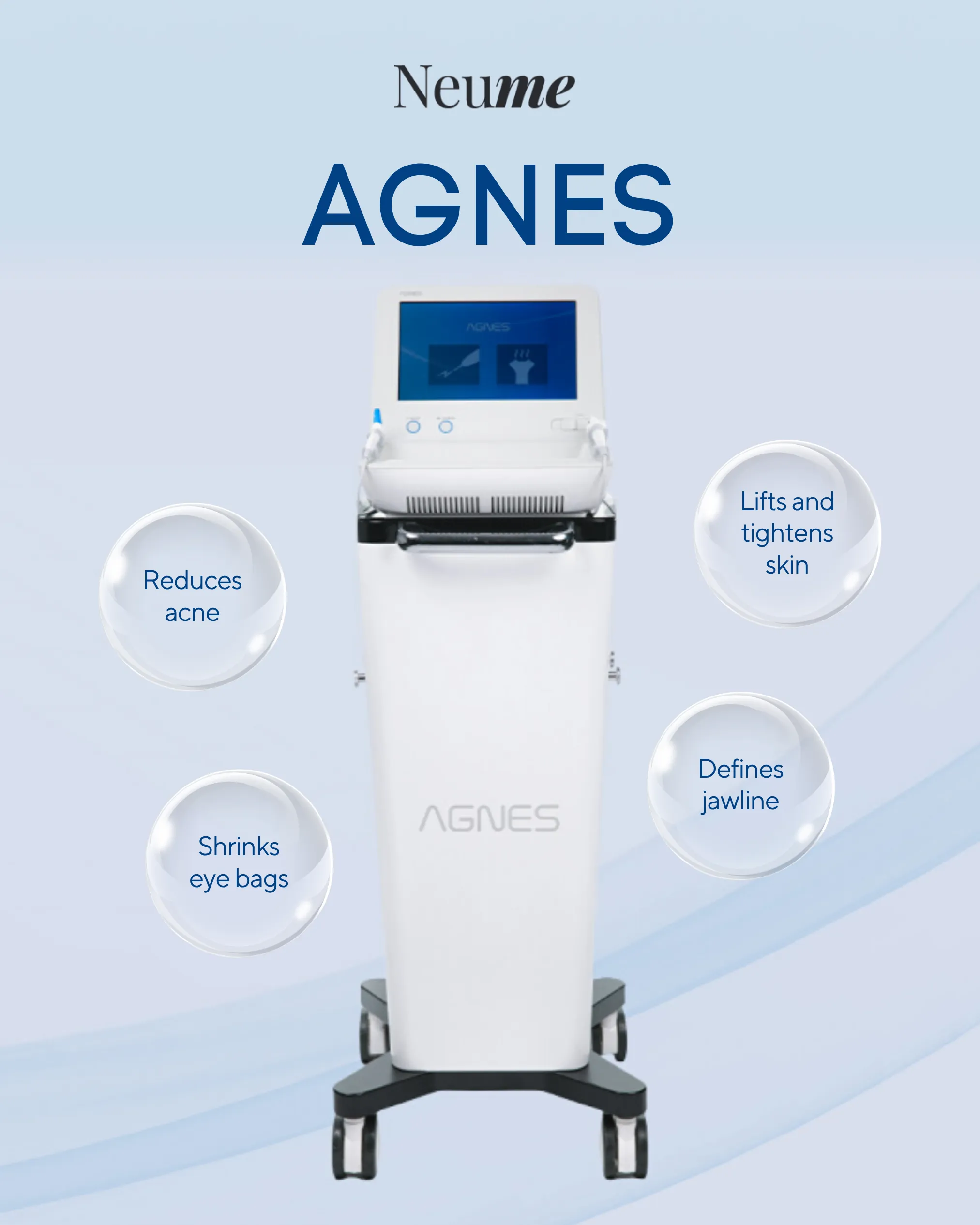 Agnes — Neume Services