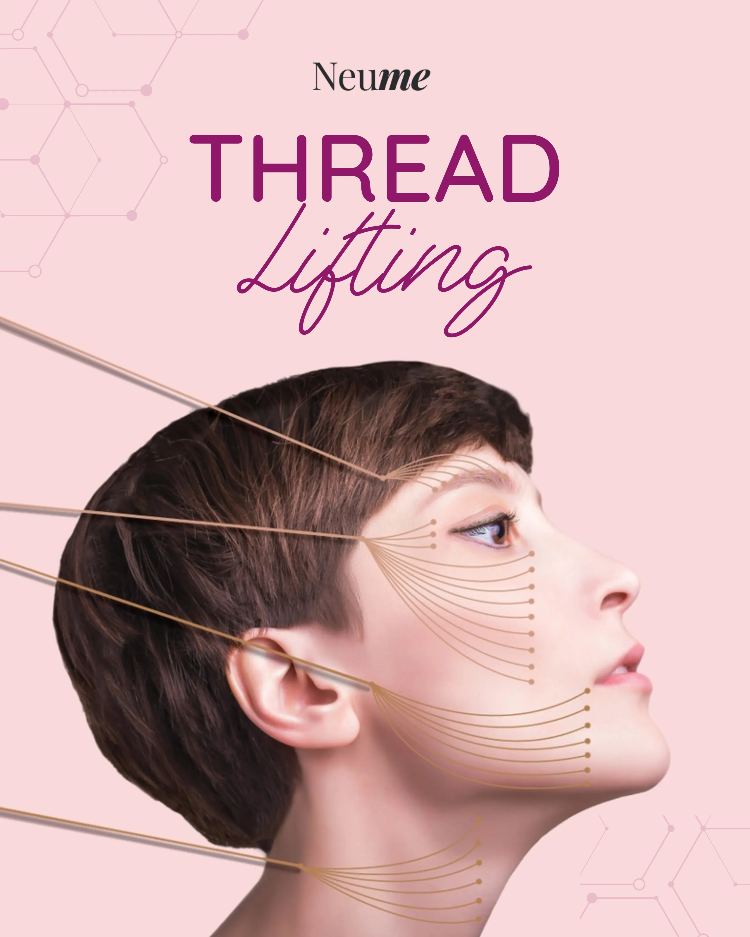 Thread Lifting — Neume Services